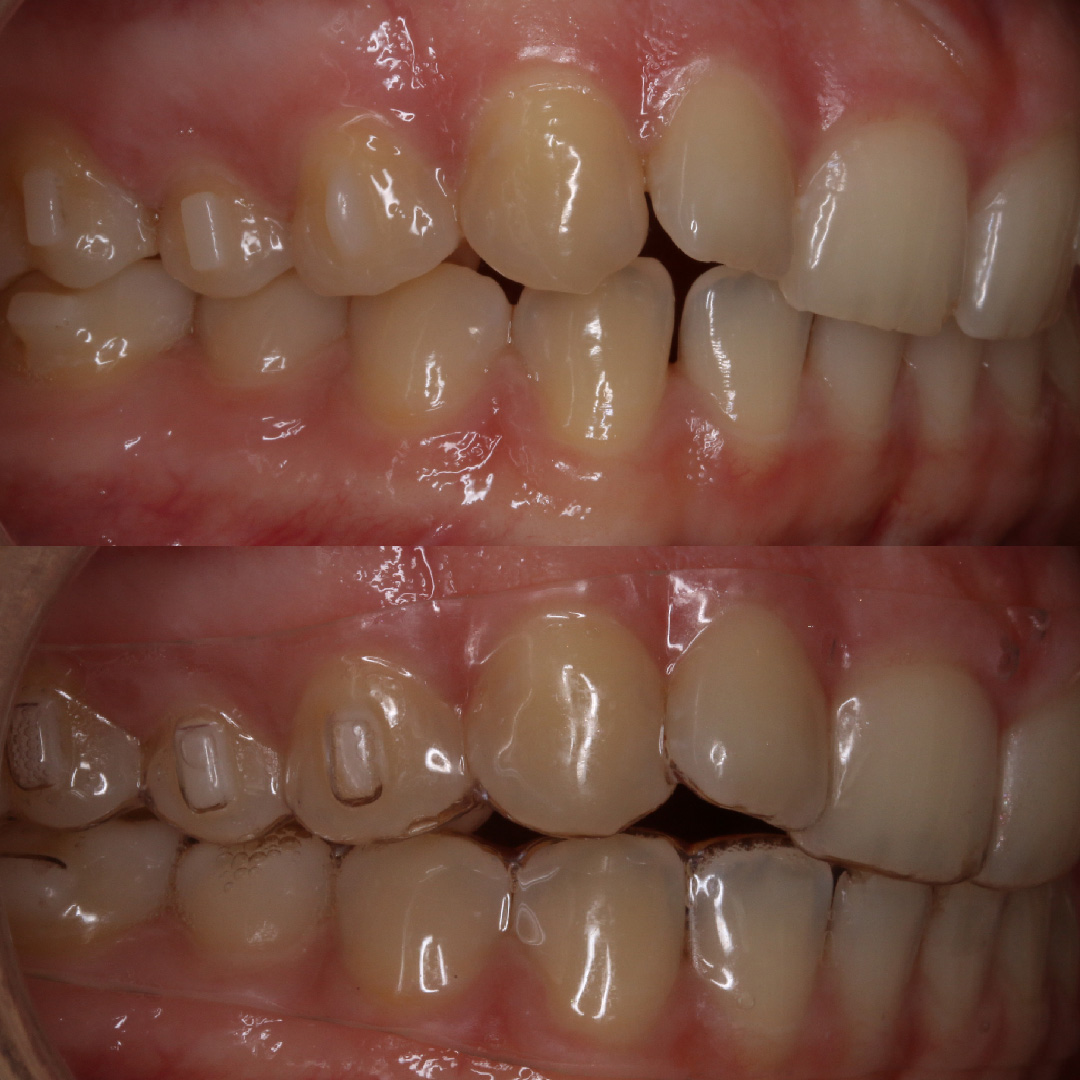 attachments - Dr. Igor Gribalsky - Sertificets Ortodonts